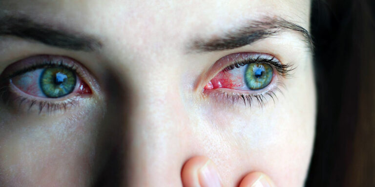 Common Eye Disorders and Diseases! - Dahlia Vision Center